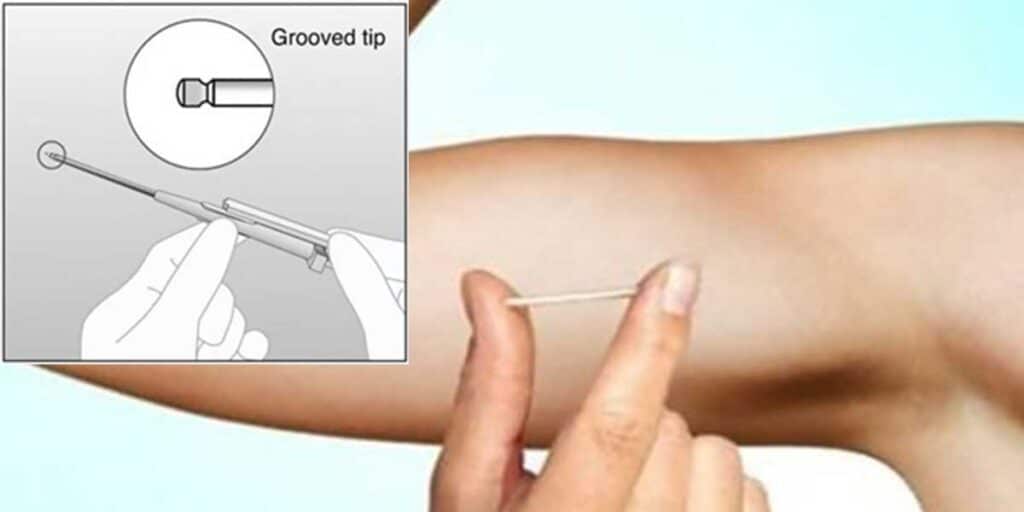 IMPLANON - Wellcare Medical Centre Kingston